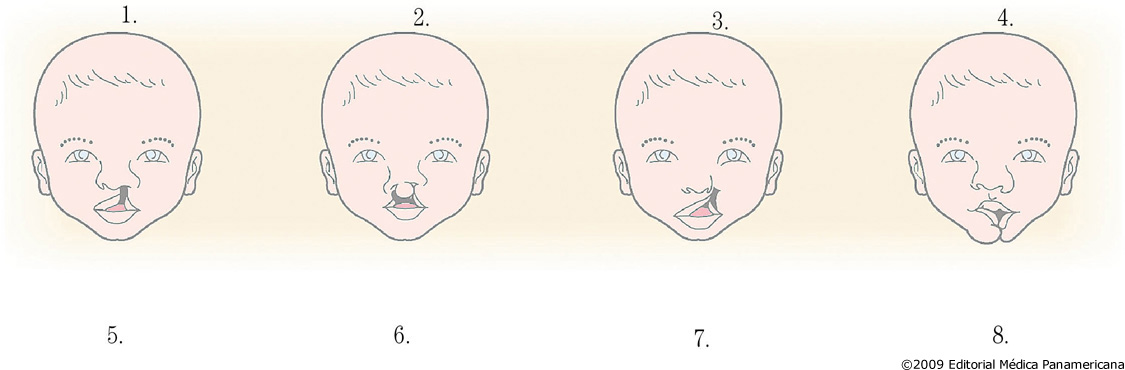 Embriología BucoDental: Biopatologia de la formacion de la cara y ...