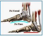 Ejercicio Terapéutico by Padrino: Ejercicios de Risser y Fuerza ...