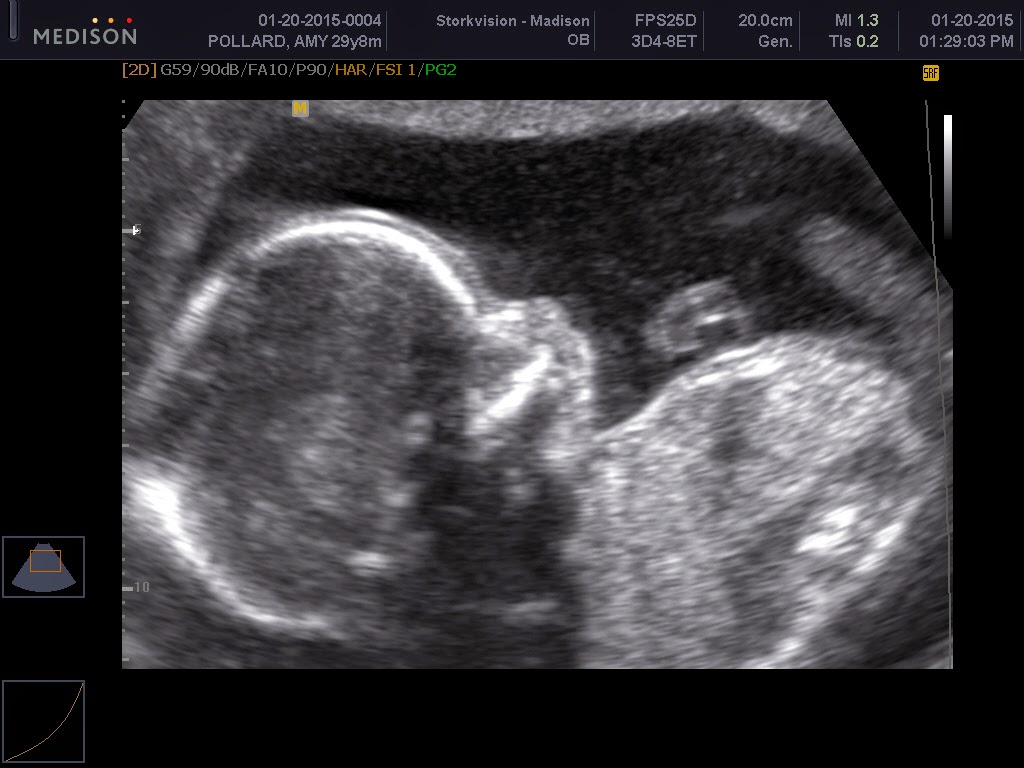 Pollard Family: Baby Pictures