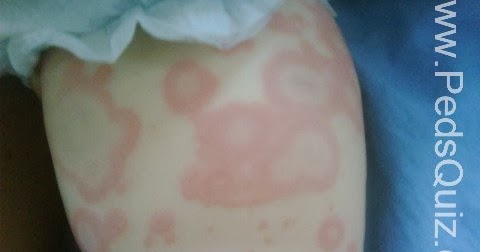 Pediatric Image Quiz - A collection of interesting images in pediatrics ...