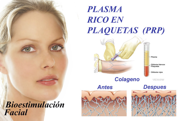 Medicina Estética Dra. Valenzuela: Plasma Rico en Plaquetas