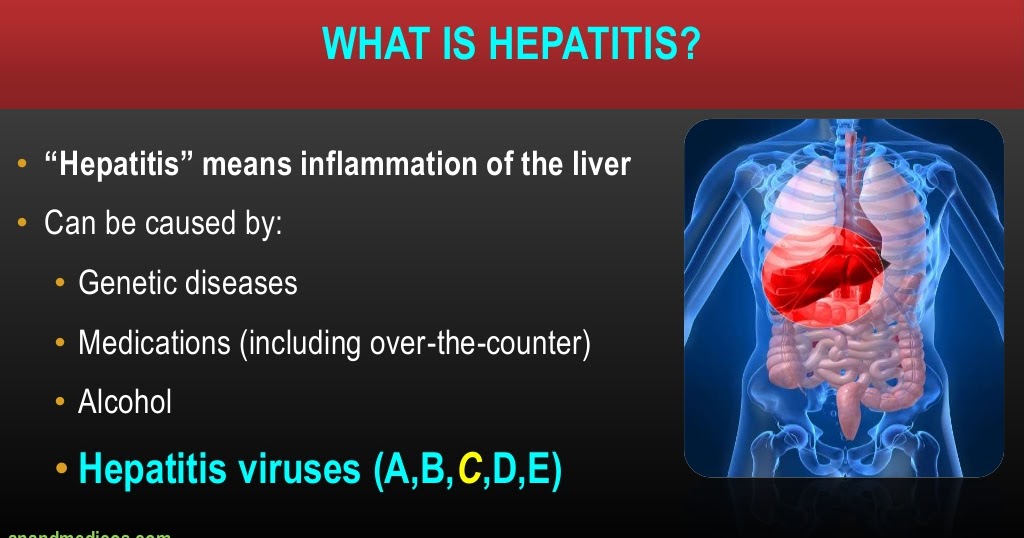 Anand Medicos: Preventive Measures For Different Types Of Hepatitis Disease