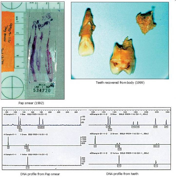 The Dental Stop: Forensic Dentistry