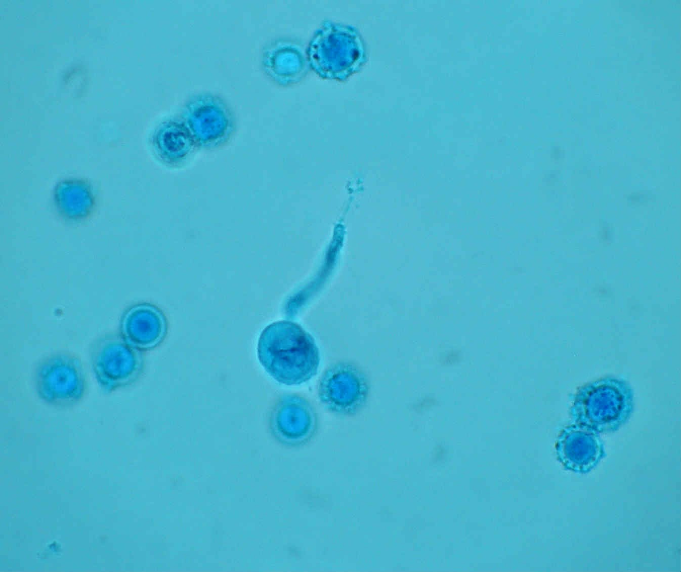 ATLAS MICOLOGIA: CONIDIOBOLUS CORONATUS