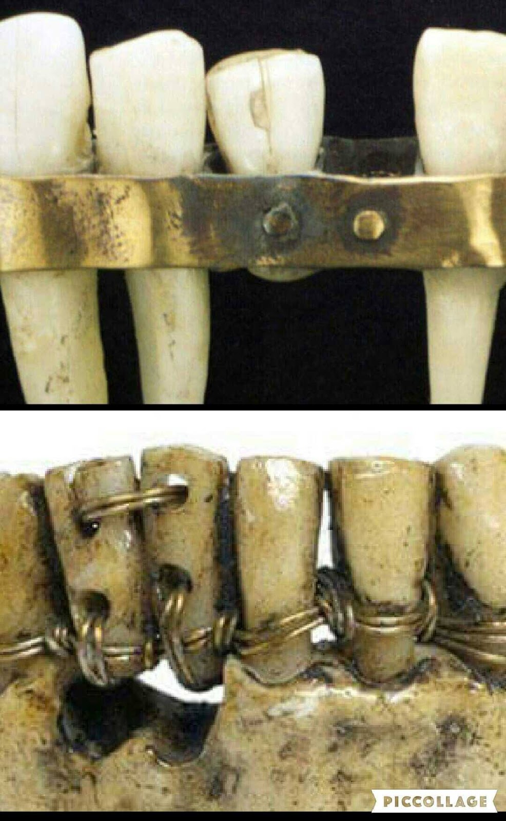 INTRODUCCIÓN A LA ODONTOLOGÍA : HISTORIA DE LA ODONTOLOGÍA