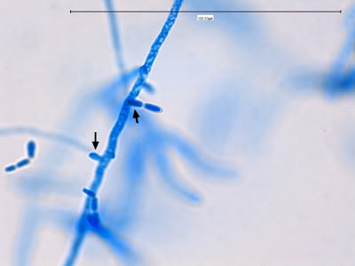 Fun With Microbiology (What's Buggin' You?): Arthrographis species