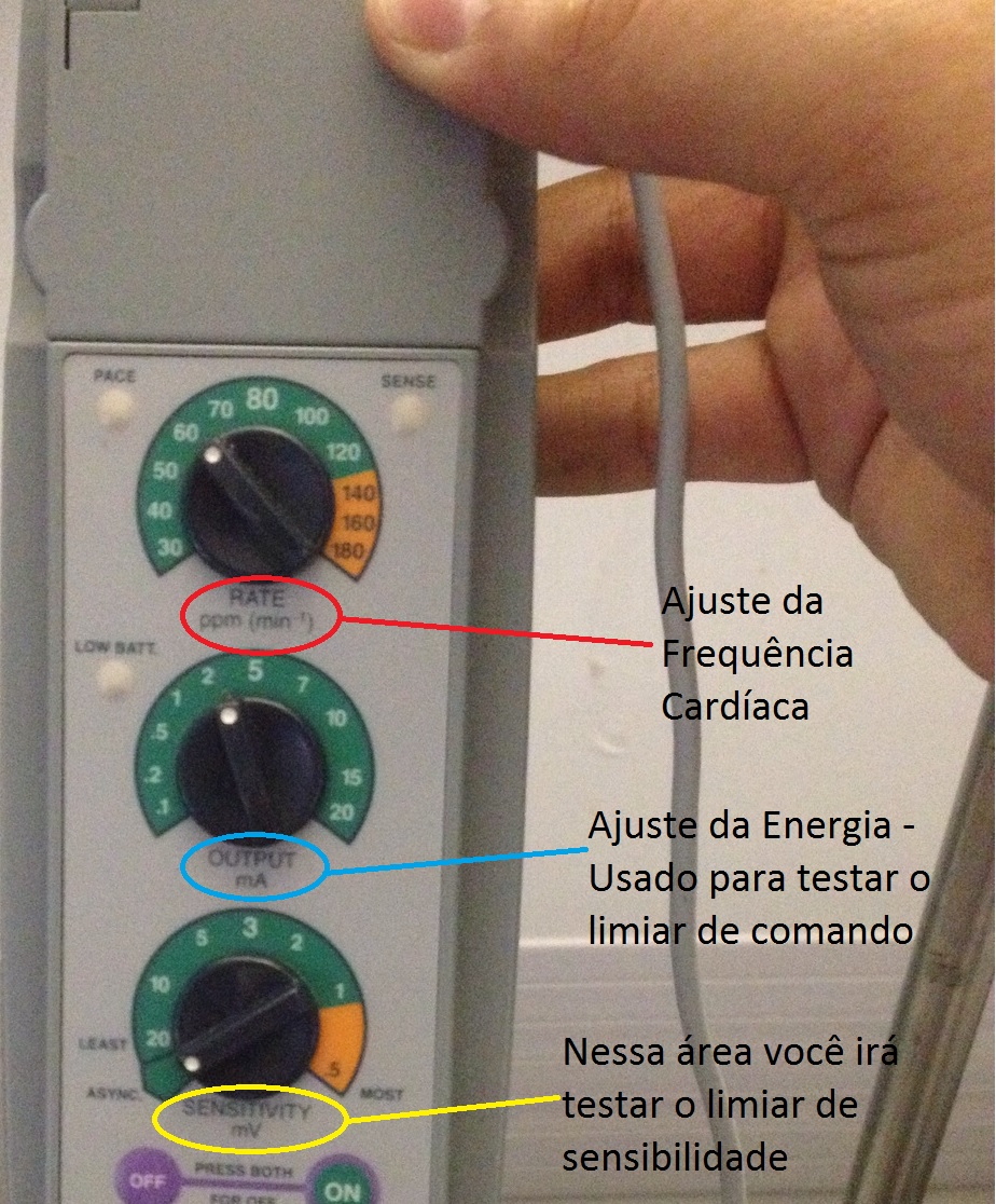 Temas em Cardiologia: Marcapasso Transvenoso - Ajuste de parâmetros básicos