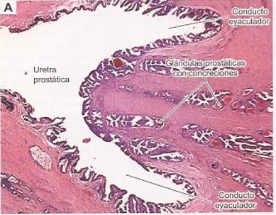 Odfelipef: Sistema urinario