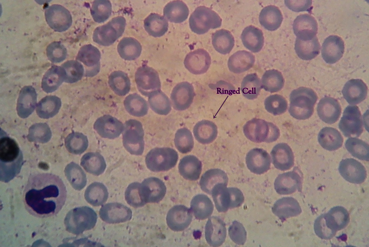 Pengenalan Morfologi Sel Erytrosit | Analis Kesehatan