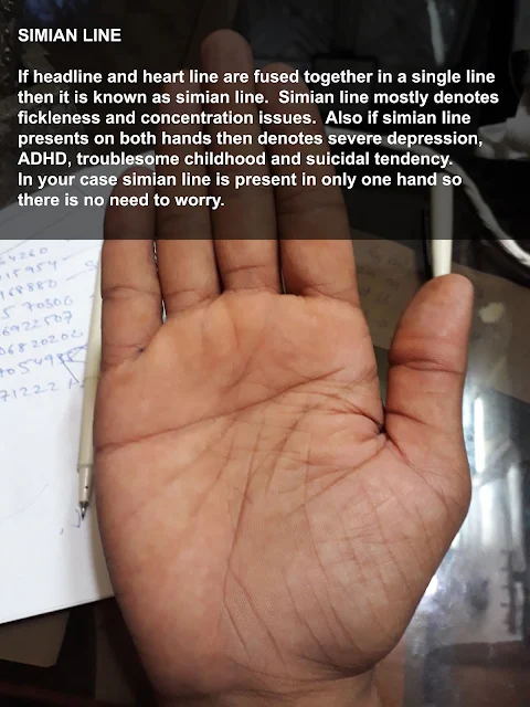 Simian Line Meaning In Hindi | Good Or Bad ~ INDIAN PALMISTRY | PALM ...