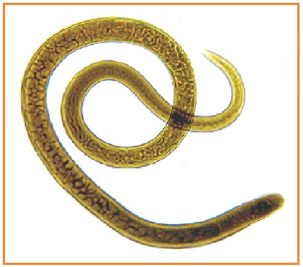 BIOLOGI GONZAGA: NEMATHELMINTHES-CACING GILIG