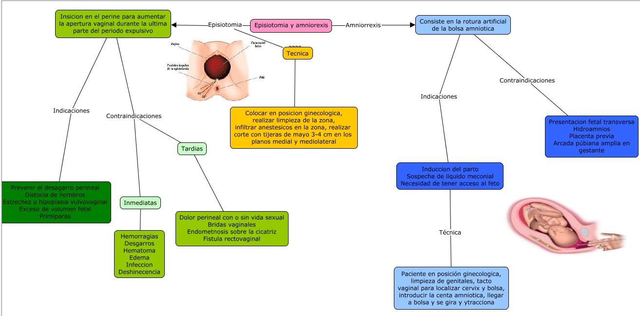 Amniorrexis y episiotomia