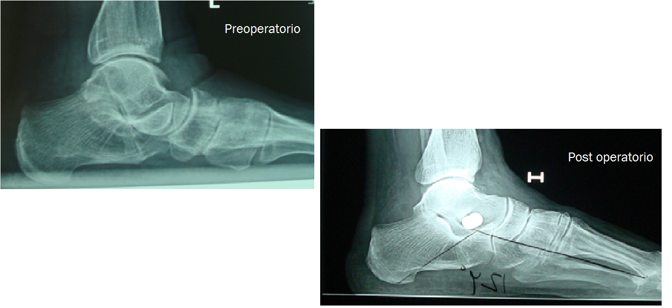 CIRUGIA ORTOPEDICA RECONSTRUCTIVA - ORTOPEDIA INFANTIL - TRAUMATOLOGIA ...