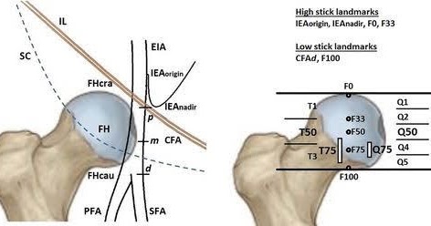 Pedi cardiology: Femoral vascular access