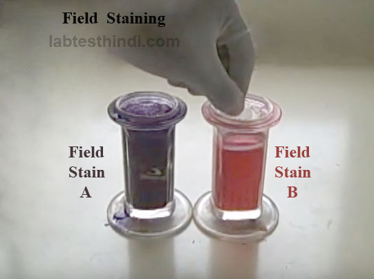Blood Smear Slide Staining कैसे करते हैं - Field Stain ~ Lab Test Hindi