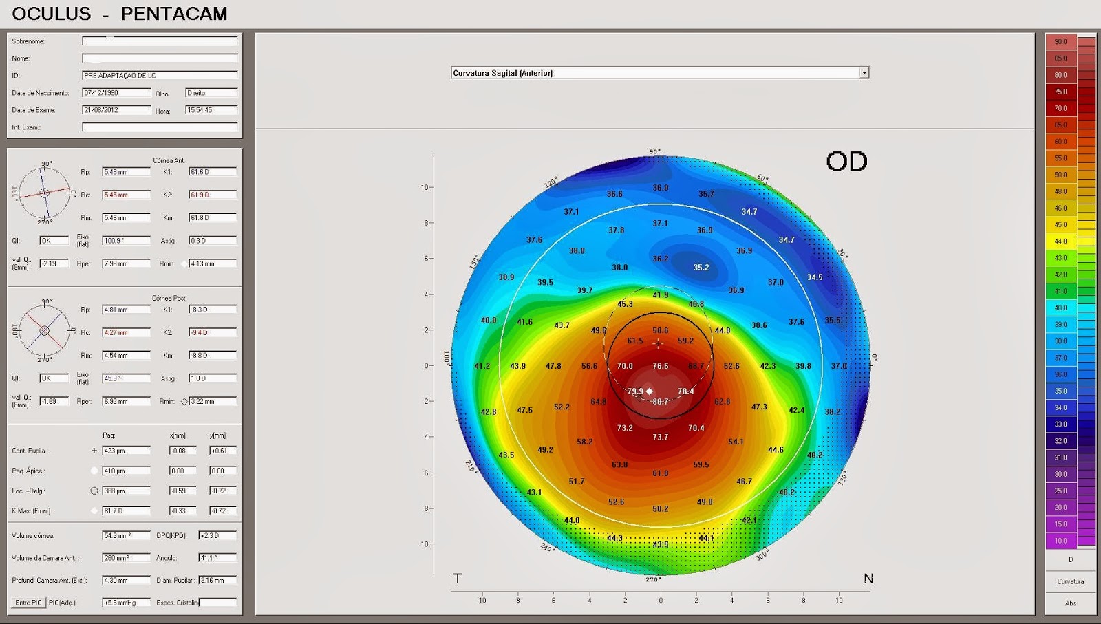 CERATOCONE & TRATAMENTOS: Equívocos que podem (e devem) ser evitados no ...