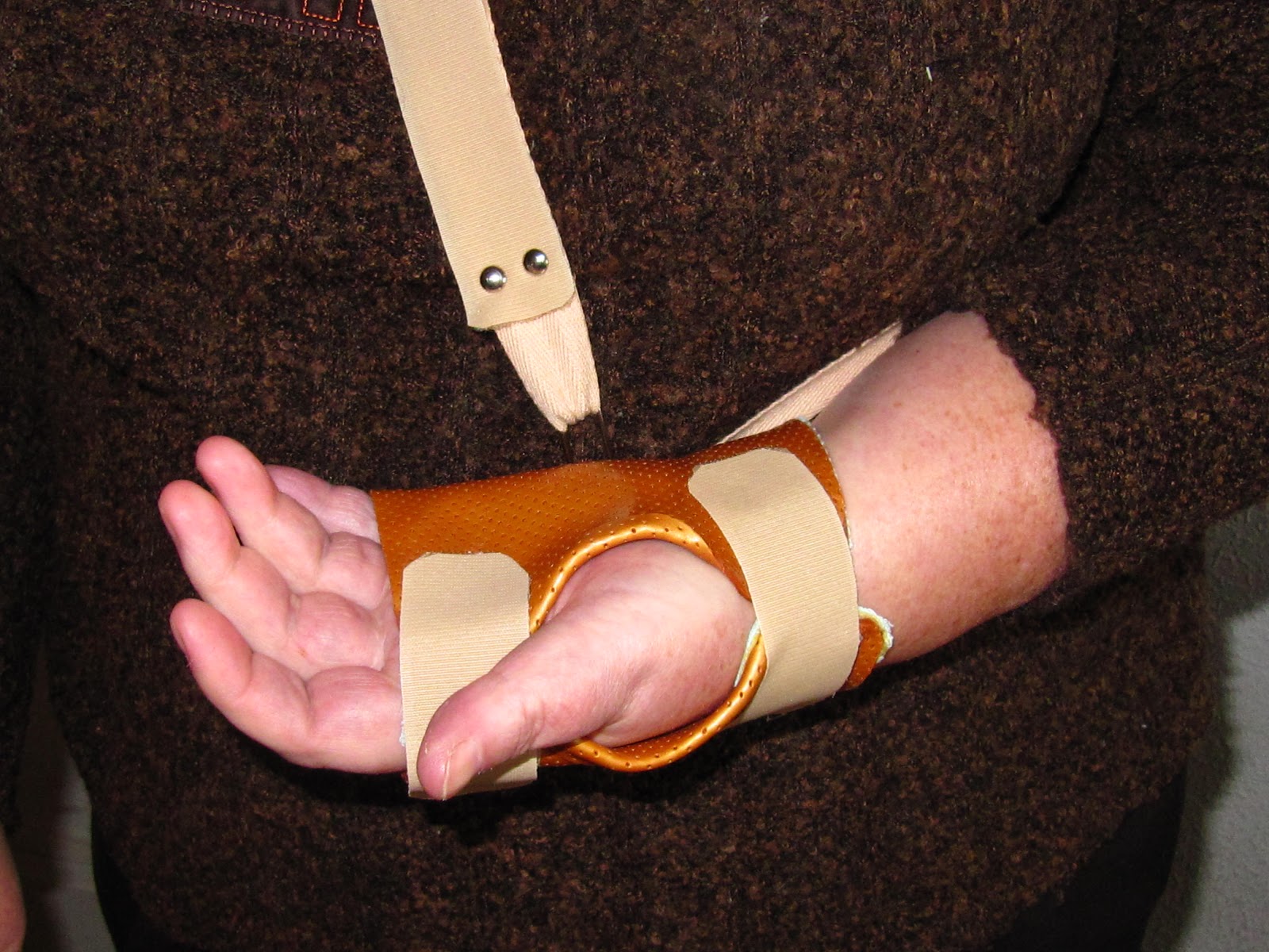 Orthèses Main-Poignet Lyon : Traumatologie