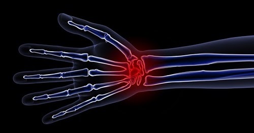 IPG Blog: Reducing Repetitive Motion Injuries at Packing Stations