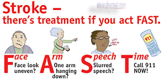 Kenali Gejala Stroke Ringan - Stroke Informations