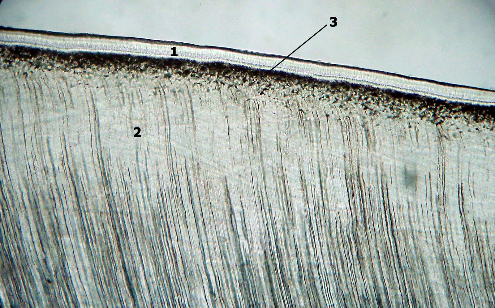 Histologia Oral UFF: Dente por desgaste