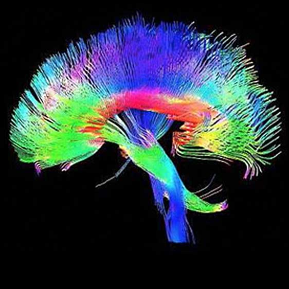 Taming the Polar Bears: Chapter One - Neuroanatomy 101