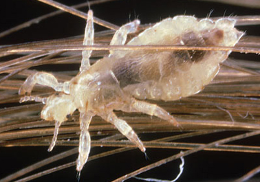 How to Kill Head Lice: What Are Lice, and Where Do They Come From?