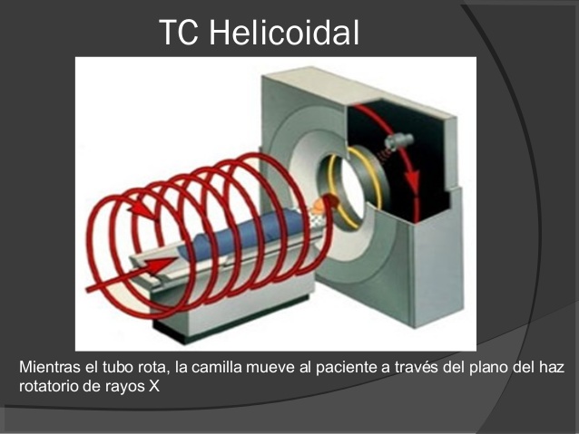 INSTRUMENTACIÓN Y EQUIPOS EN DIAGNOSTICO POR IMÁGENES: TC HELICOIDAL Y TCMD