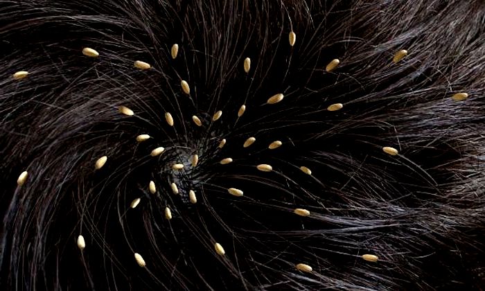 Sparta: Kasur Sarang Kuman jamur Kutu & Bakteri