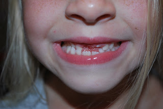 The Warrens: Snaggletooth