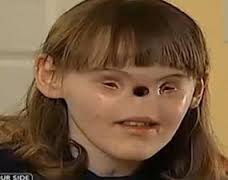 Inspirational Bursts: Cassidy Hooper: The girl who was born without ...