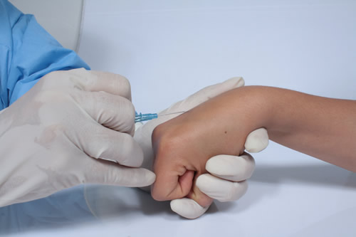 Extravasaciones de vías venosas periféricas ¿quién? ¿cómo? y ¿cuándo ...