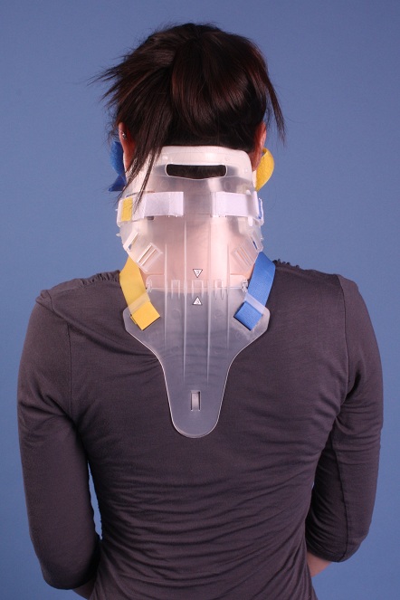 2º GBM: The XCollar