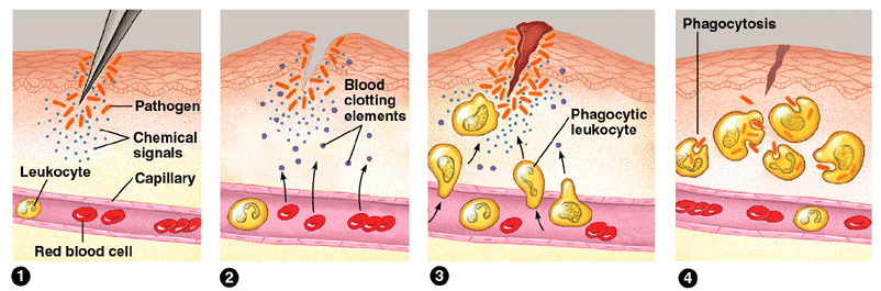 e-biolearning: Pertahanan Tubuh dan Respon Imun