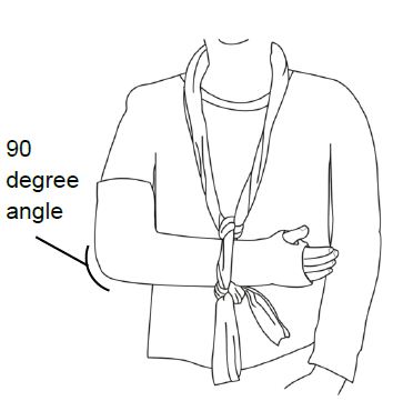HMSPromedicServices: Cara Penggunaan Anduh (sling)