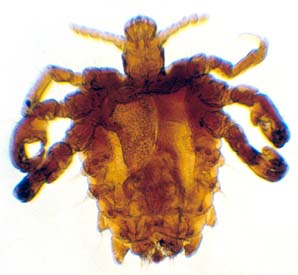 Las Ladillas | Remedios Caseros