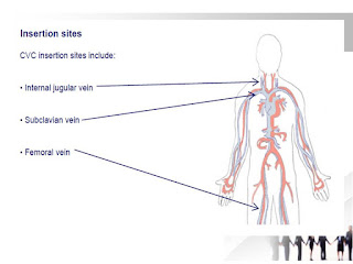 Keperawatanku: Pemasangan Central Venous Catheter (CVC) dan Pengukuran ...