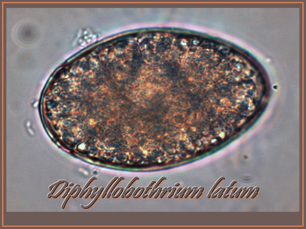Diphyllobothrium Latum Indonesian Medical Laboratory - Riset