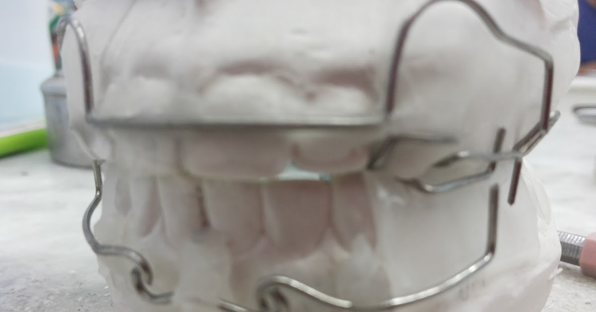 Ortobella: Frankel classe II.