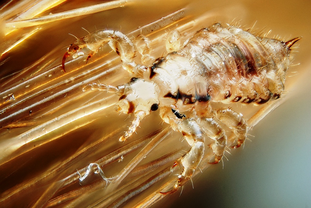 albertnet: From the Archives - Holiday Newsletter About HEAD LICE! GROSS!