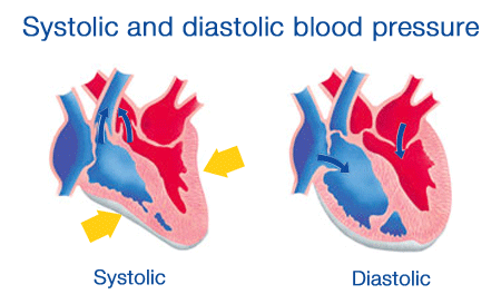trends vcv: BLOOD PRESSURE - THAT WHICH HAS TO BE MONITORED ALWAYS:::::