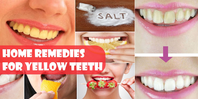 How To Get Rid Of Yellow Teeth By Using 4 Home Remedies! - Style Hunt World