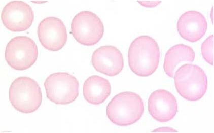 BIOMETRIA HEMATICA: Aprende Sobre Biometria Hematica