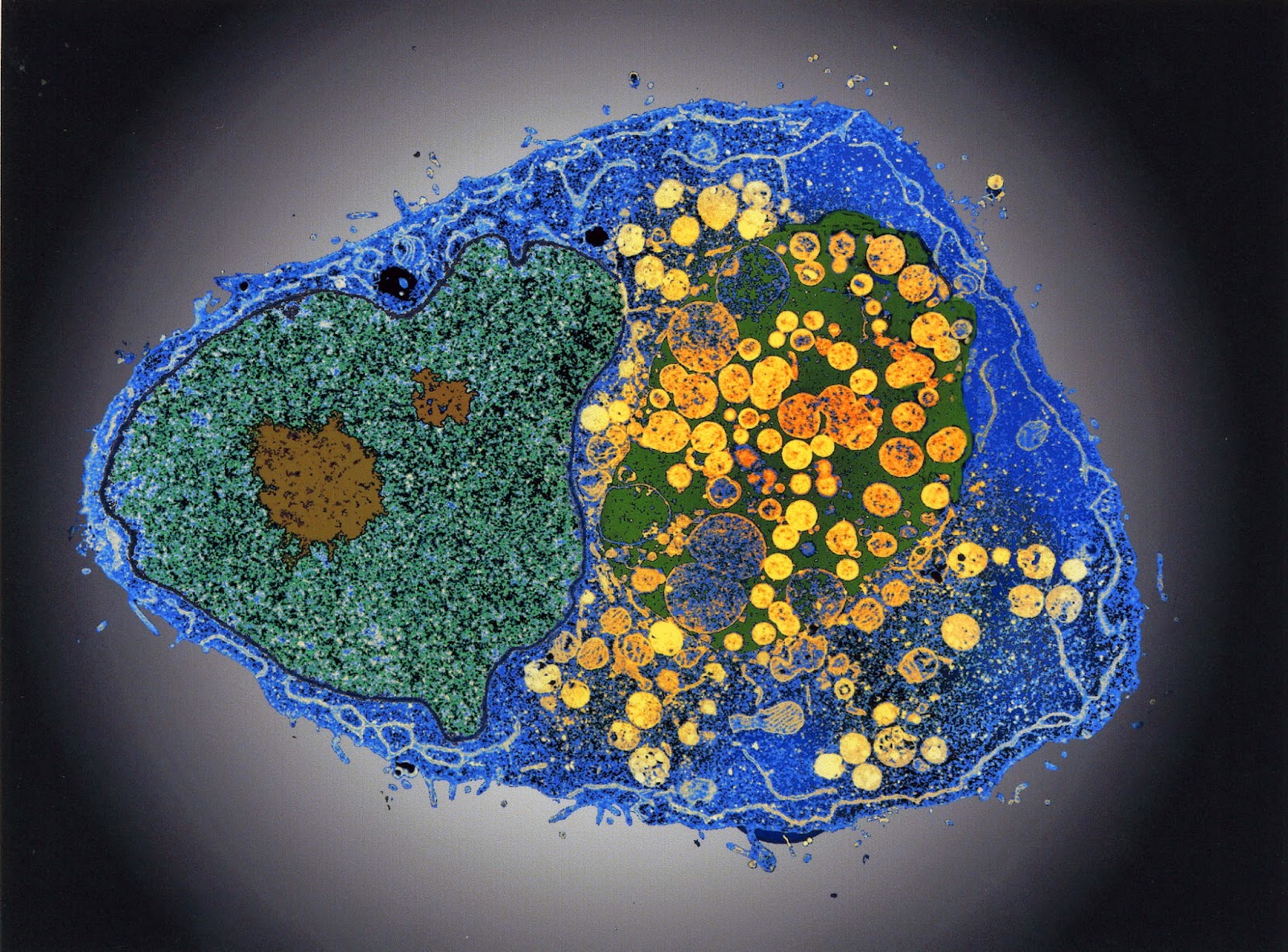 Chlamydia ~ infectious diseases