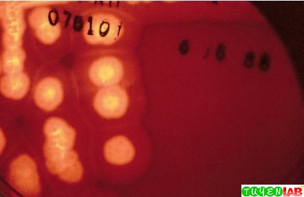 [Microbiology] Atlas of Anaerobes of Clinical Importance | Free Medical ...