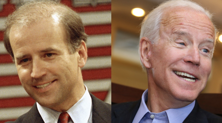 Botox, hair plugs, and veneers: Biden could escape the cosmetic surgery ...