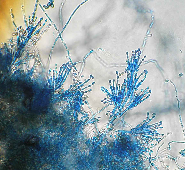 ATLAS MICOLOGIA: PAECILOMYCES VARIOTII