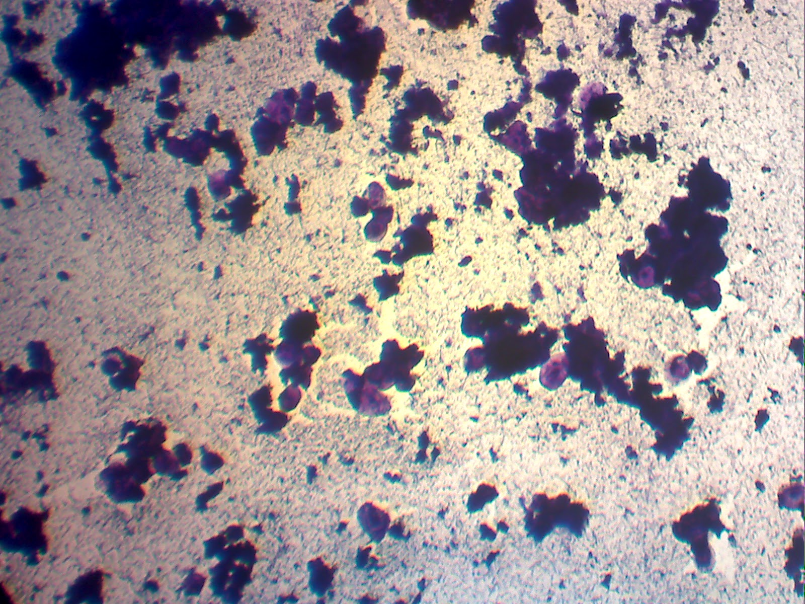 Pangea Arts and Sciences: Gram Staining a Heat Fixed Smear Slide