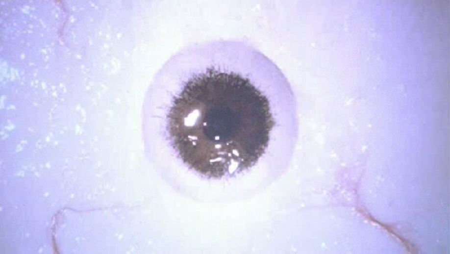 The Bloody Pit of Horror: Brain Damage (1988)