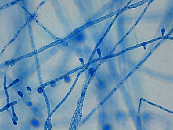 Fun With Microbiology (What's Buggin' You?): Microsporum gypseum