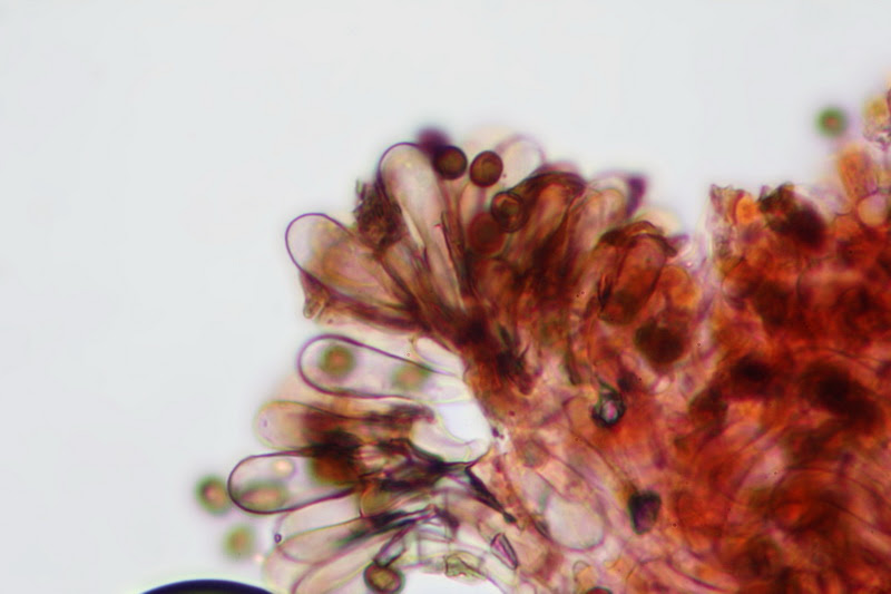 El mundo microscópico de los hongos: Agaricus bisporus (Lge.)Sing.